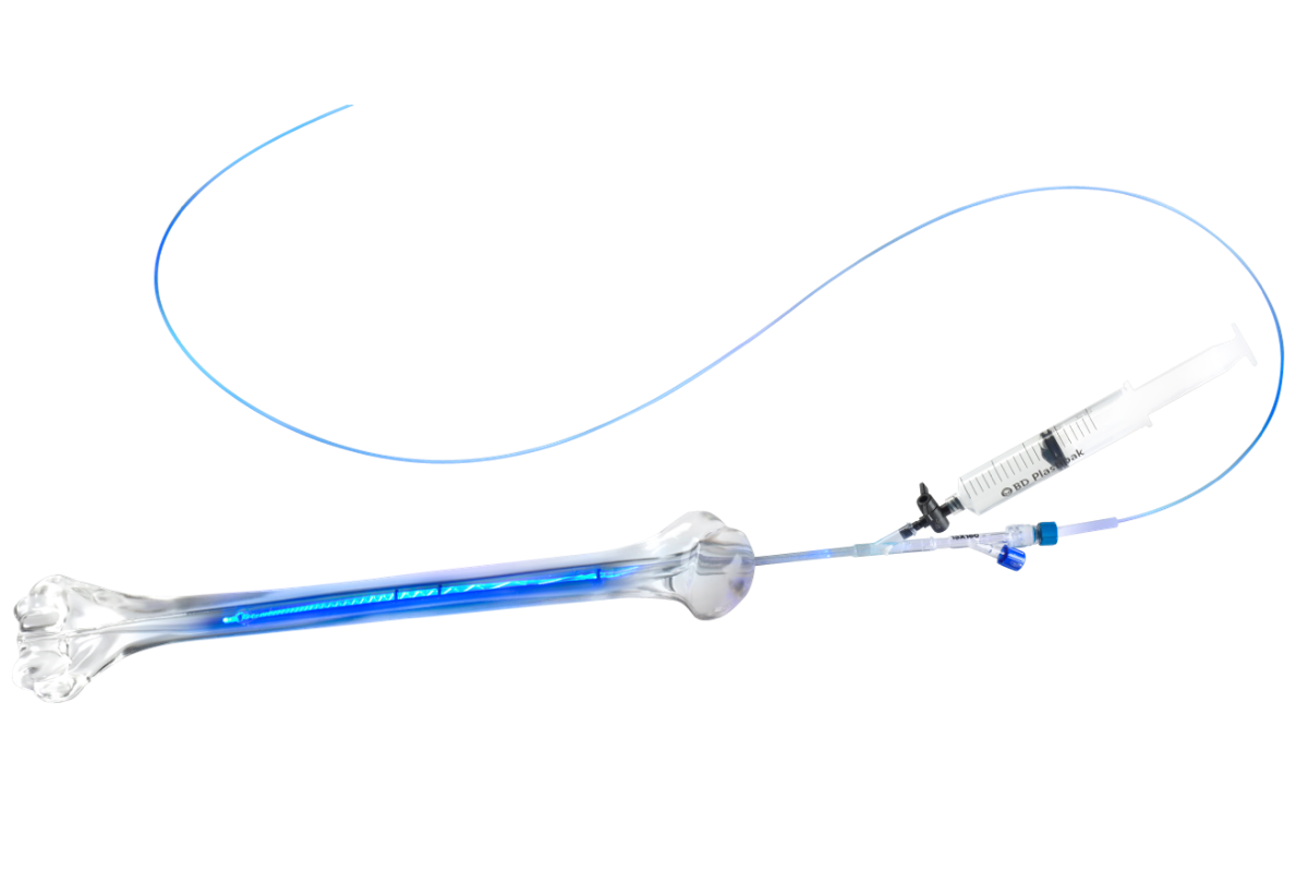 IlluminOss - Fracture Repair at the Speed of Light